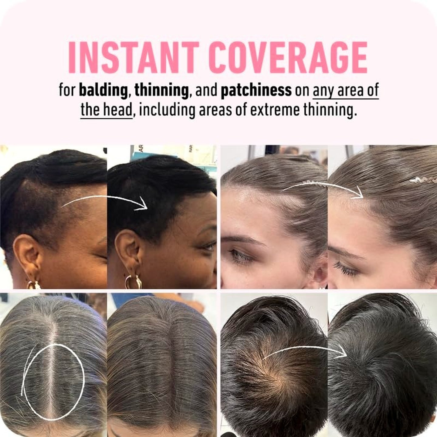 Boldify Hair Powder Transforms Thinning Hair Spotty Beards | HuffPost Life