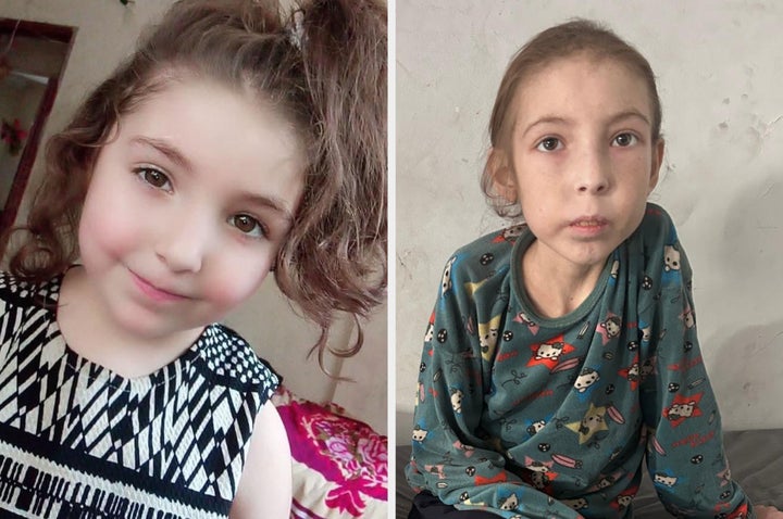 Rahaf Is 12 And Lives In Gaza. All She Wants Is For Her Hair To Grow ...
