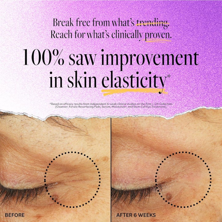 Derma E Lifting Eye Treatment: A $19 Facelift In A Tube | HuffPost Life