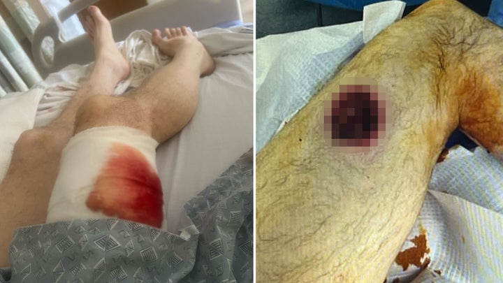 Dozens Of Journalists Targeted, Shot, Detained While Covering LA ...