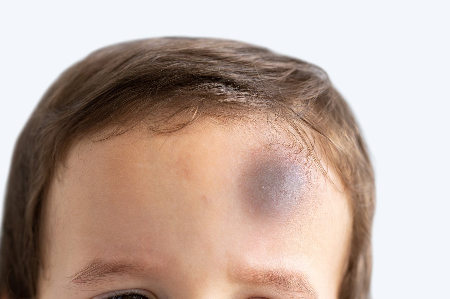 If Your Child's Head Bump Feels Like This, It's Time To Call For Help ...
