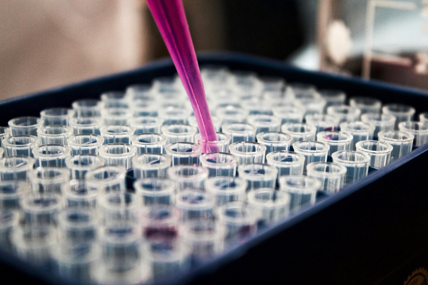 NHS Launched A 'Sponge On A String' Test: Here's Why | HuffPost UK Life