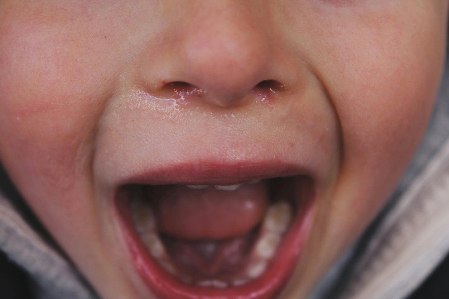 My Kid Bit Another Child – What Should I Do? | HuffPost UK Parents