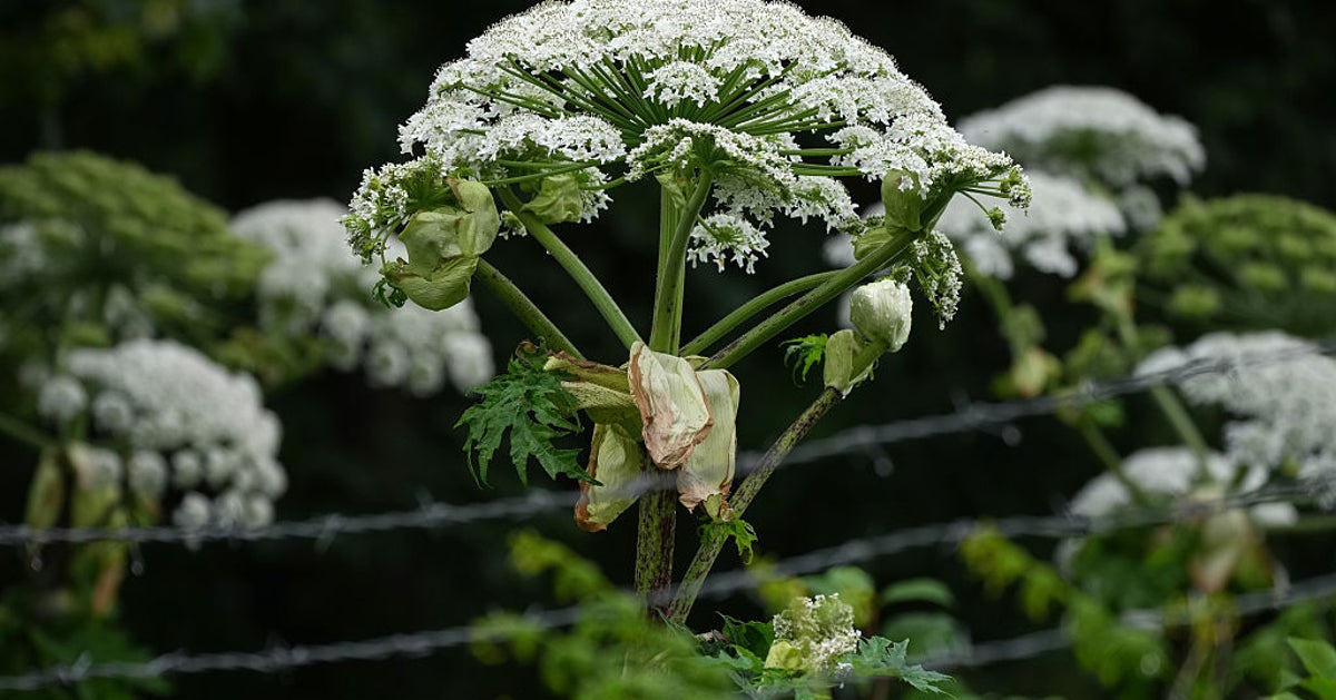 Giant Hogweed Warning After Toddler Left With Huge Blister | HuffPost ...