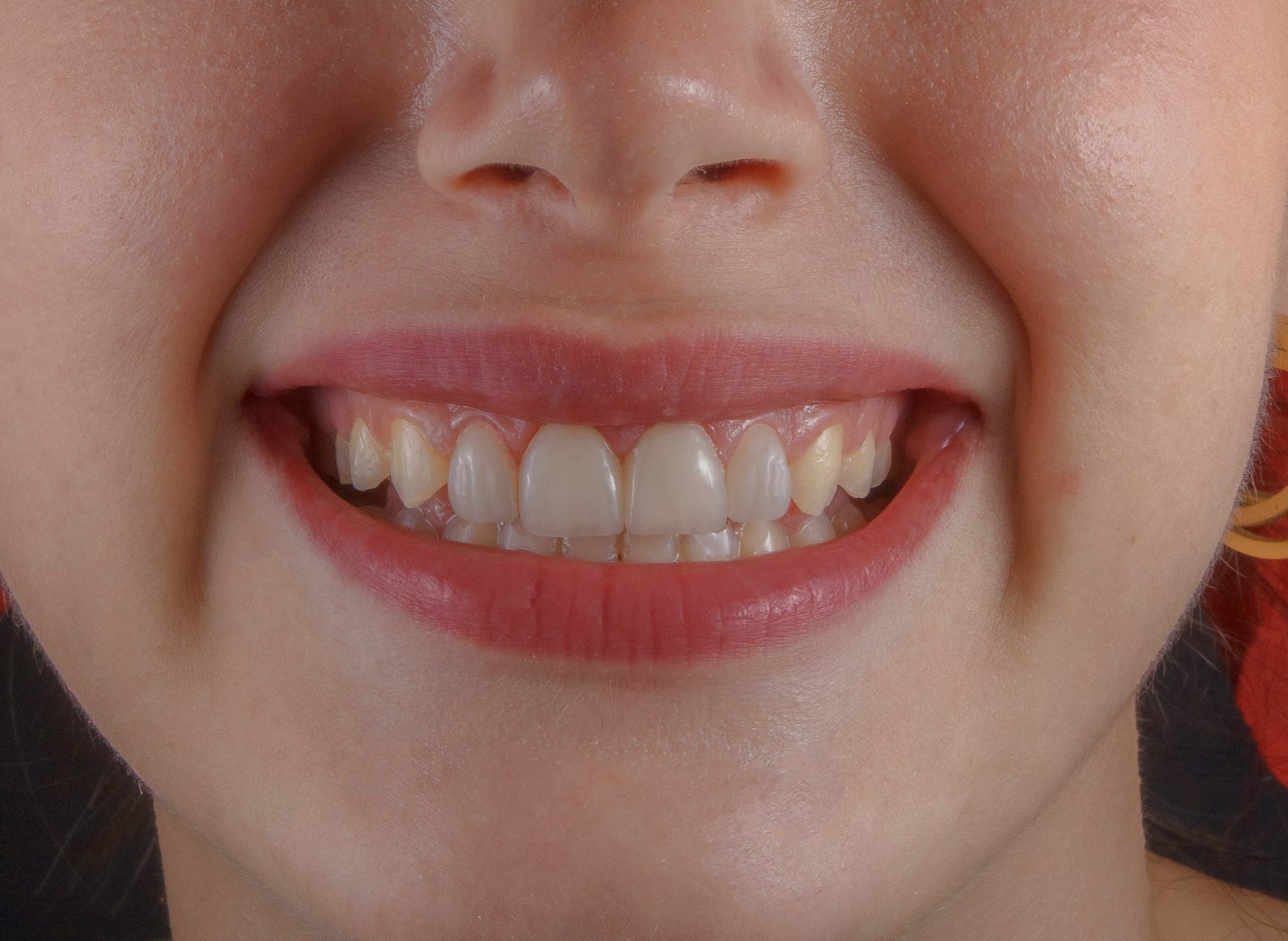 Hair Toothpaste May Be The Future Of Tooth Repair | HuffPost UK Life