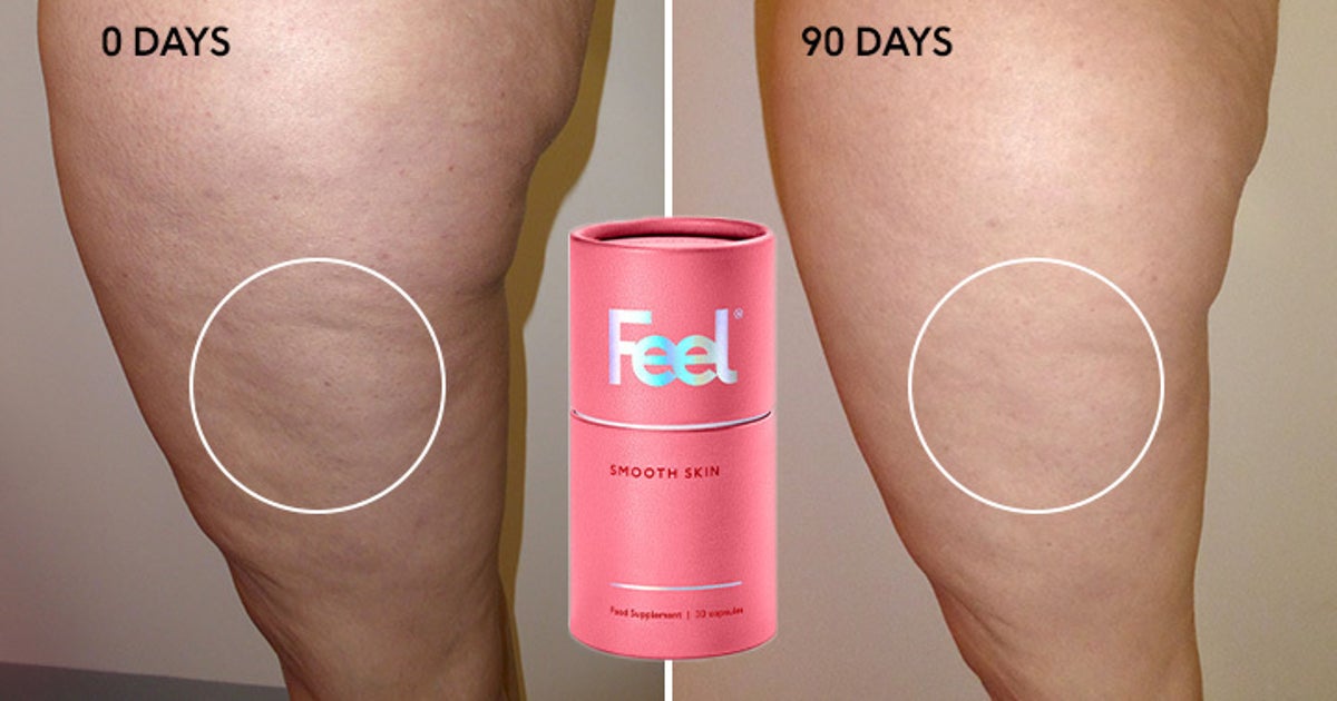 This Is The UK's First Anti-Cellulite Supplement – How Does It Work ...