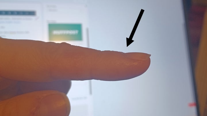 This Nail Change Could Be A Sign Of Lung Issues | HuffPost UK Life
