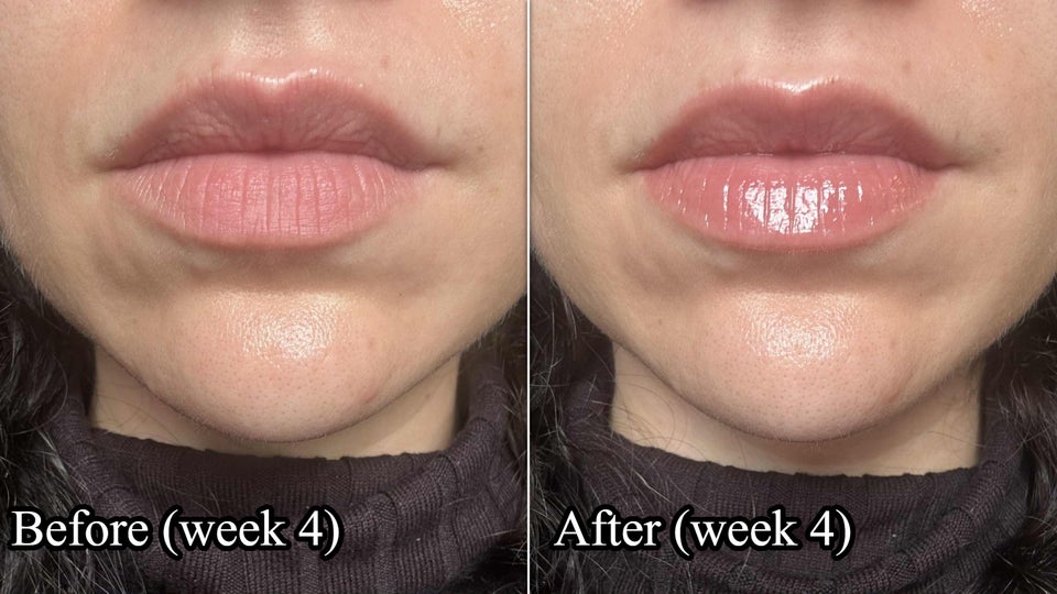 I Tried RoC's Lip Volumizer For A Month: An Honest Review | HuffPost UK ...