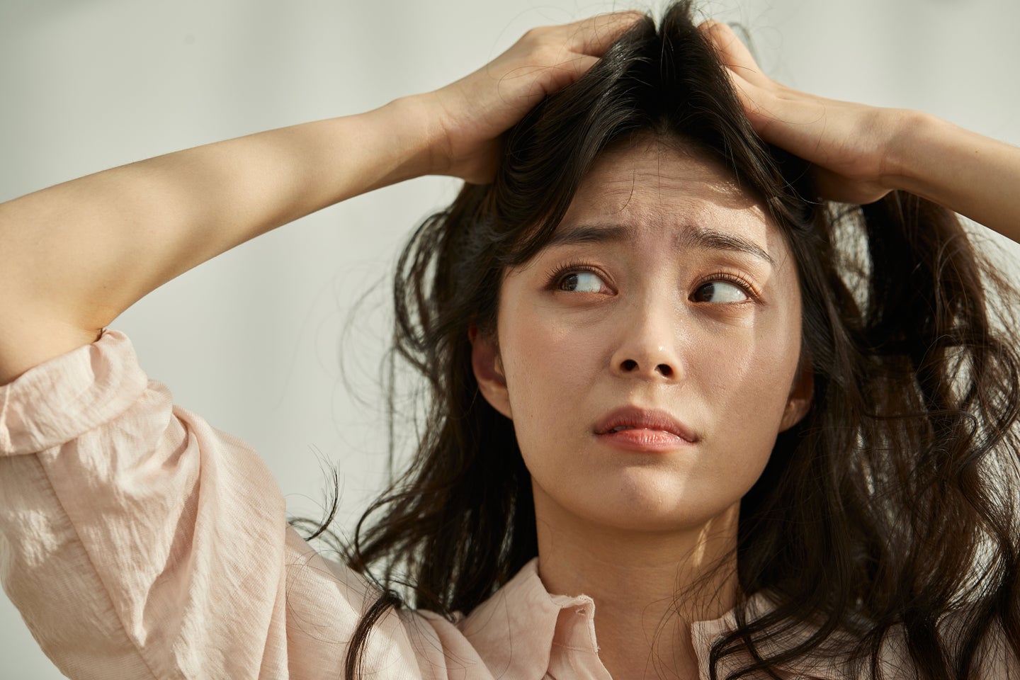 Dandruff Is Tied To Hair Loss And Thinning: Here's How To Prevent It ...