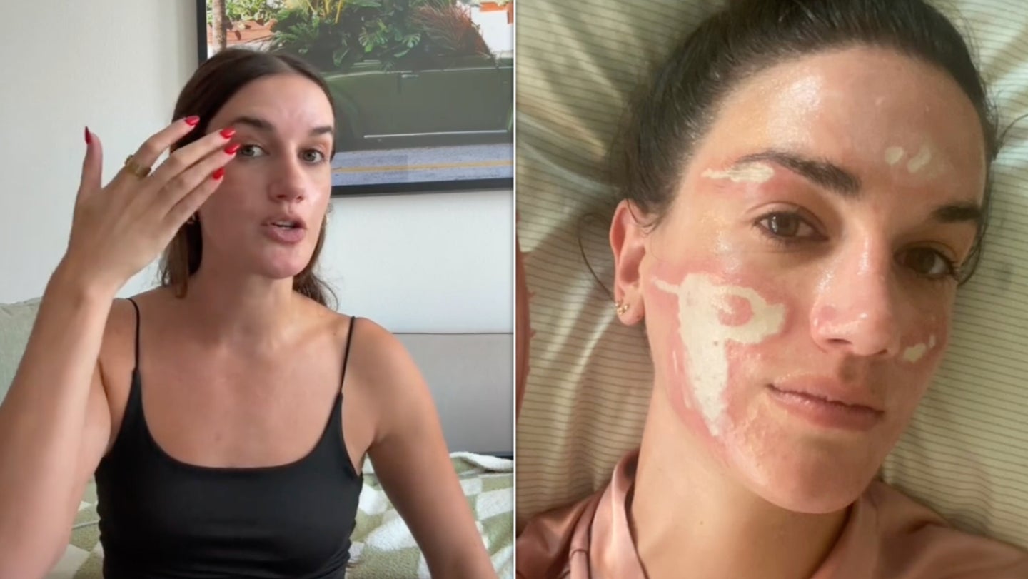 Woman Sues 'Skincare Guru' Over Face Damage | HuffPost Entertainment