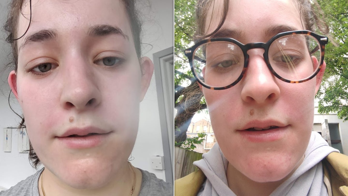 What Does It Mean If Your Face Goes Red After Exercise? | HuffPost UK Life