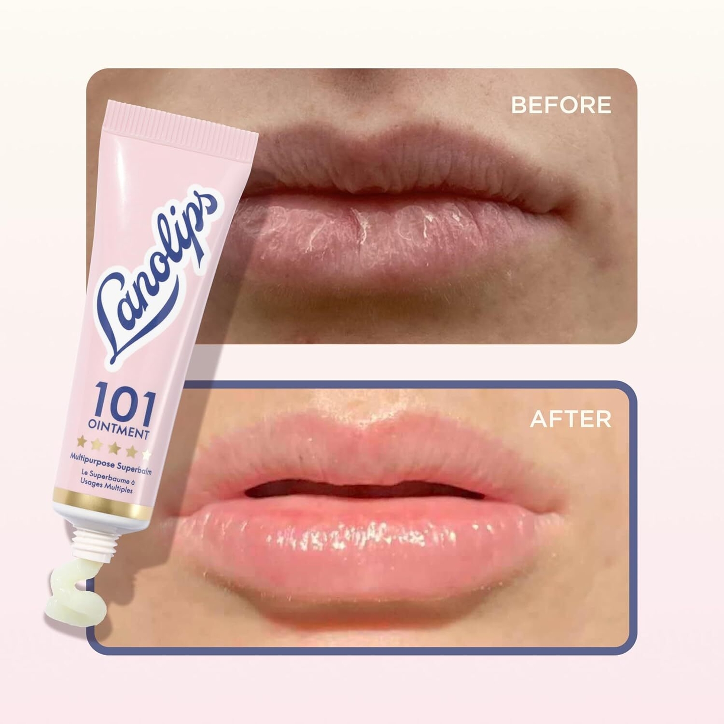 Lanolips 101 Ointment Lip Balm Stays On Like Magic | HuffPost Life