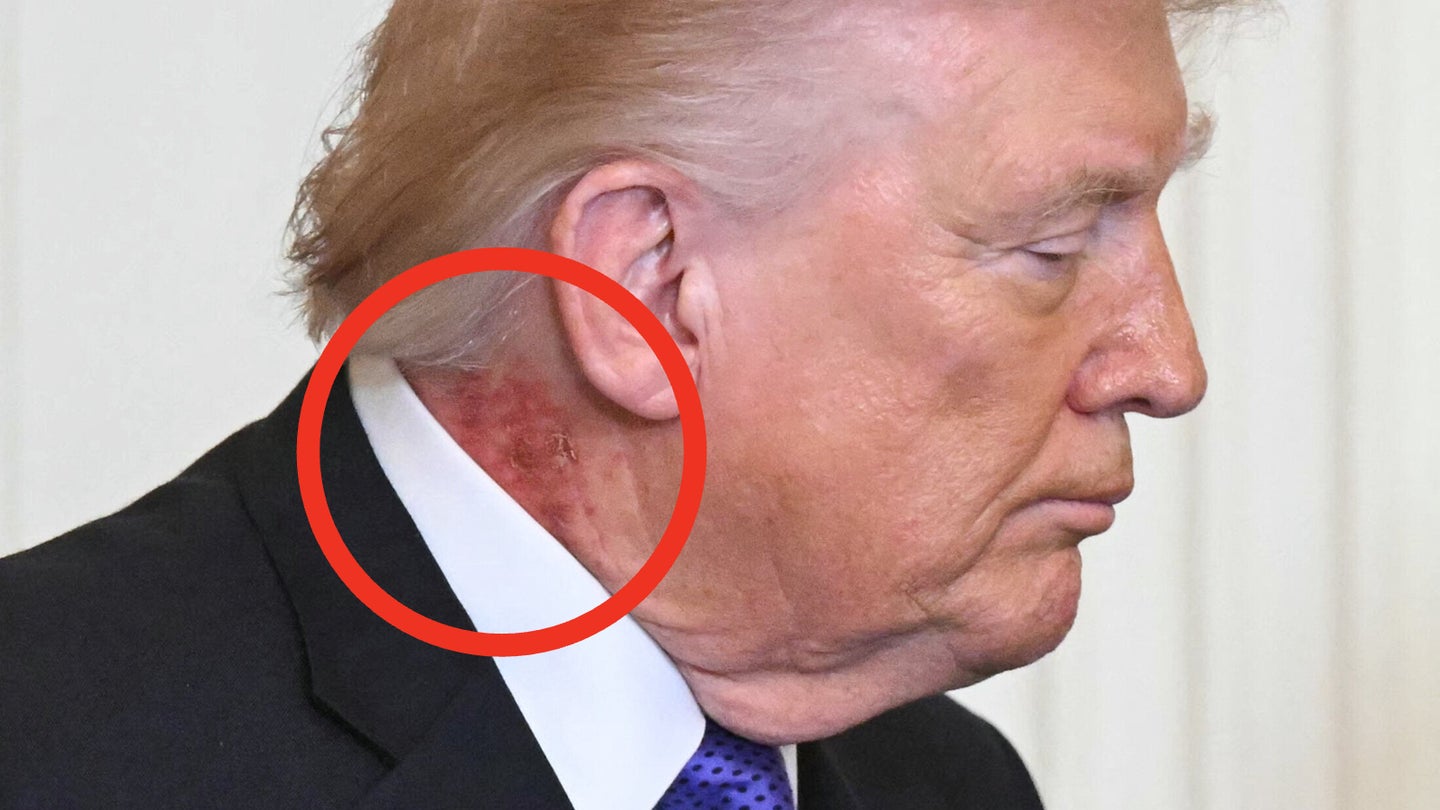 Looks Like President Trump Has Some Sort Of Gnarly Neck Rash | HuffPost ...