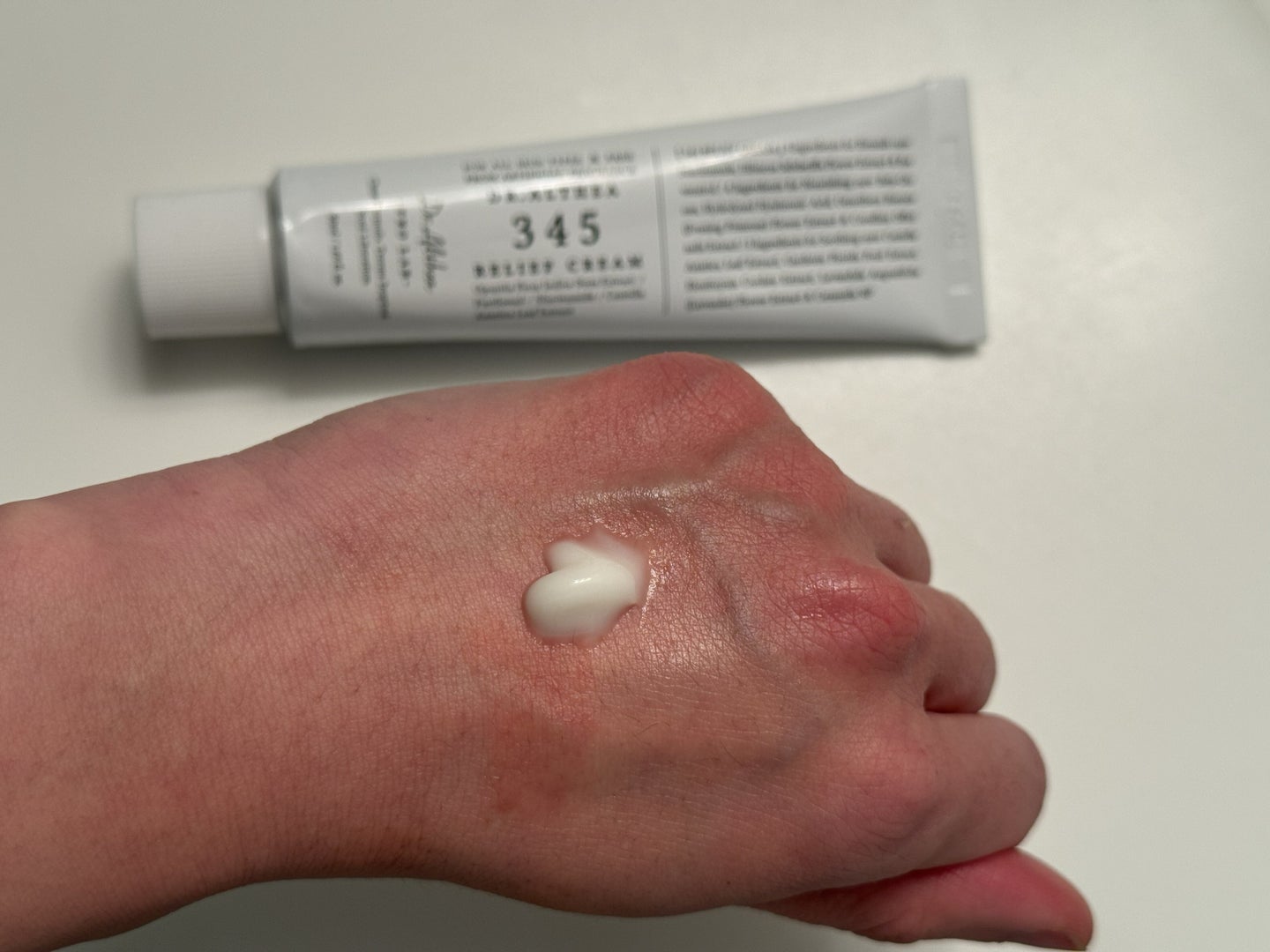 This K-Beauty Relief Cream Calmed My Inflamed Skin So Fast | HuffPost Life