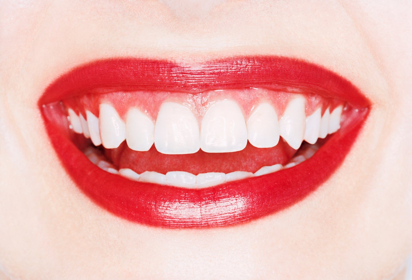 Americans' Perfect White Teeth Seem Odd To People In Other Countries ...