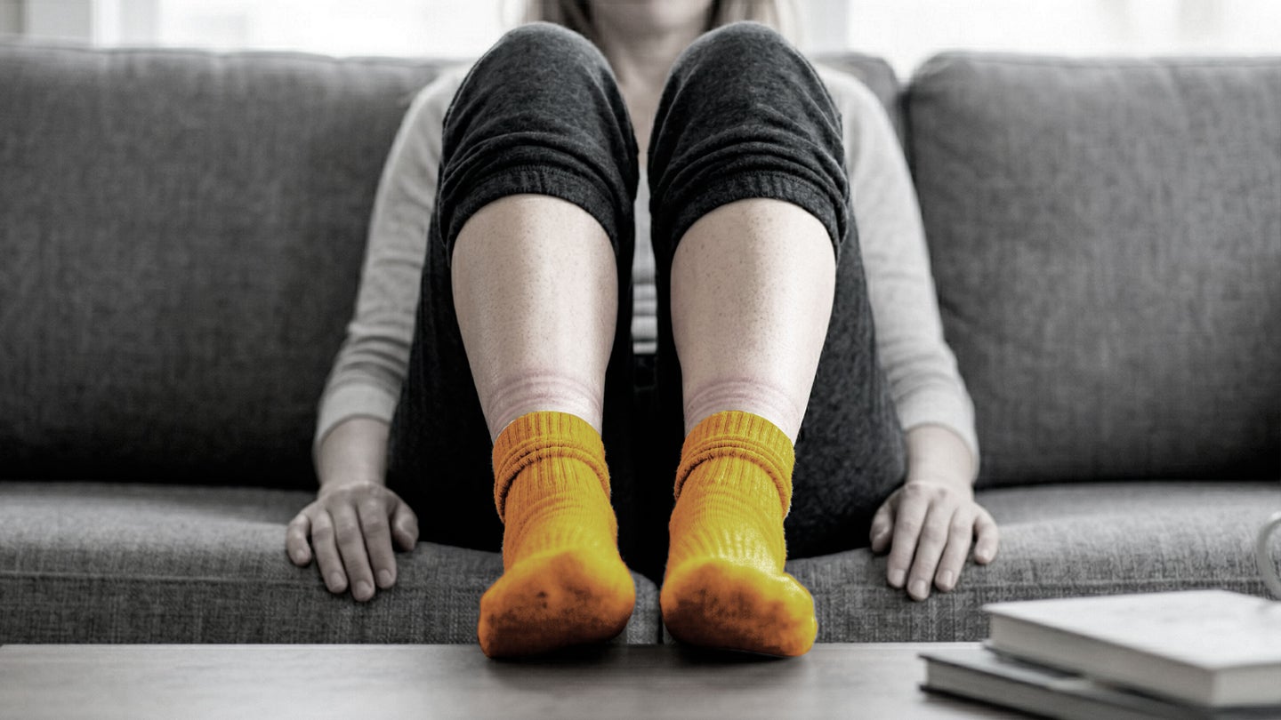 What Sock Marks On Your Legs Could Reveal About Your Health | HuffPost Life