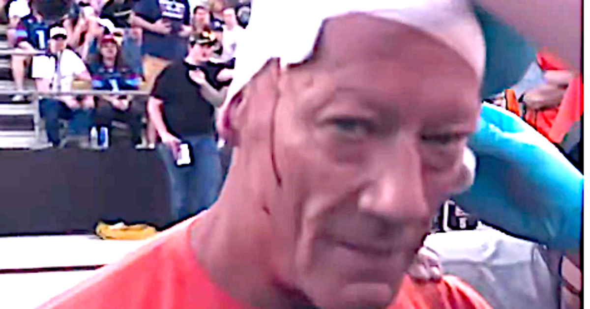 Bloodied Football Camera Operator's Response To Monster Hit Is ...